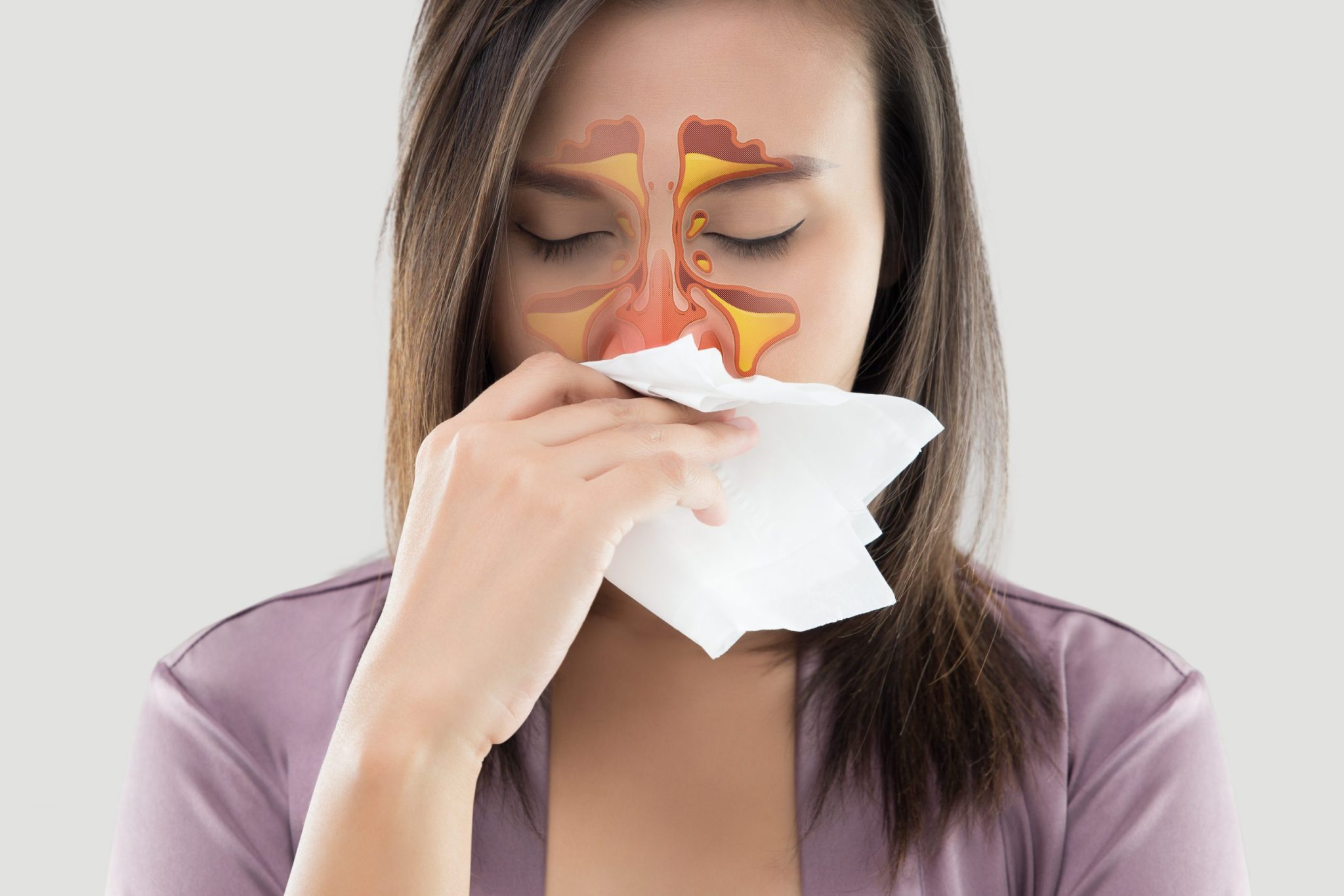 Do I Have Sinusitis, and How Can I Treat It? (Updated 2024) | Surgical ...